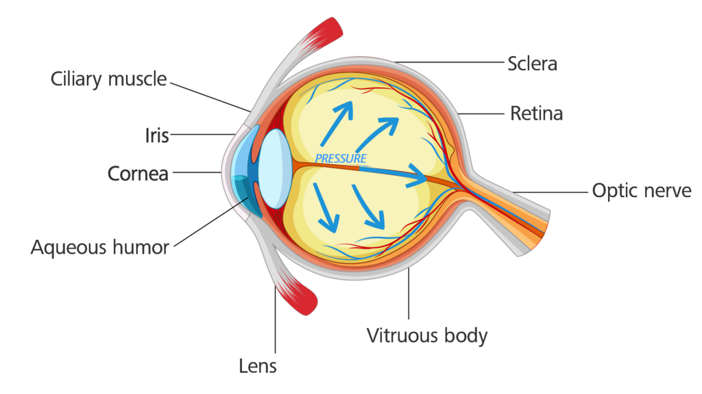 Glaucoma – todo lo que debe saber acerca de la segunda causa principal ...